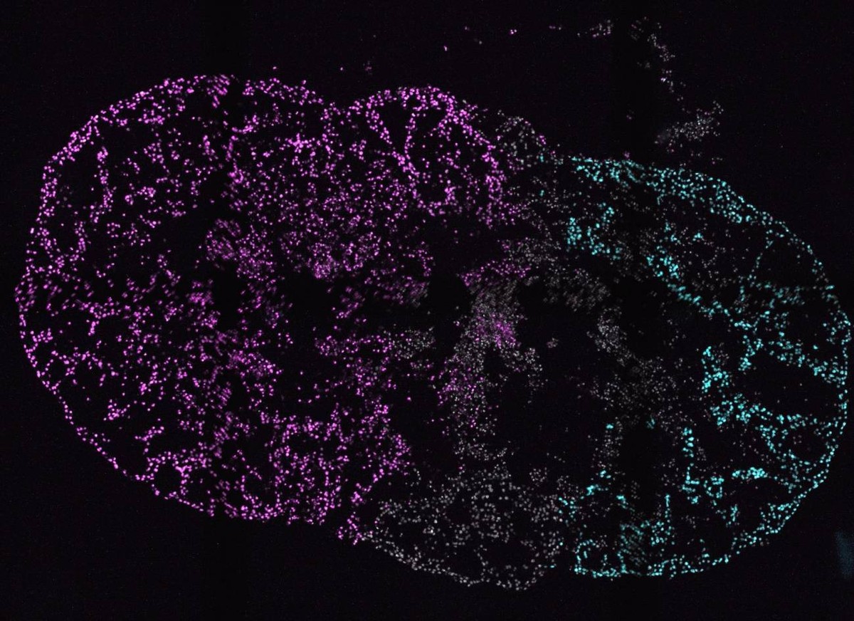 Créez un organoïde avec de multiples cavités qui reflètent la structure ...
